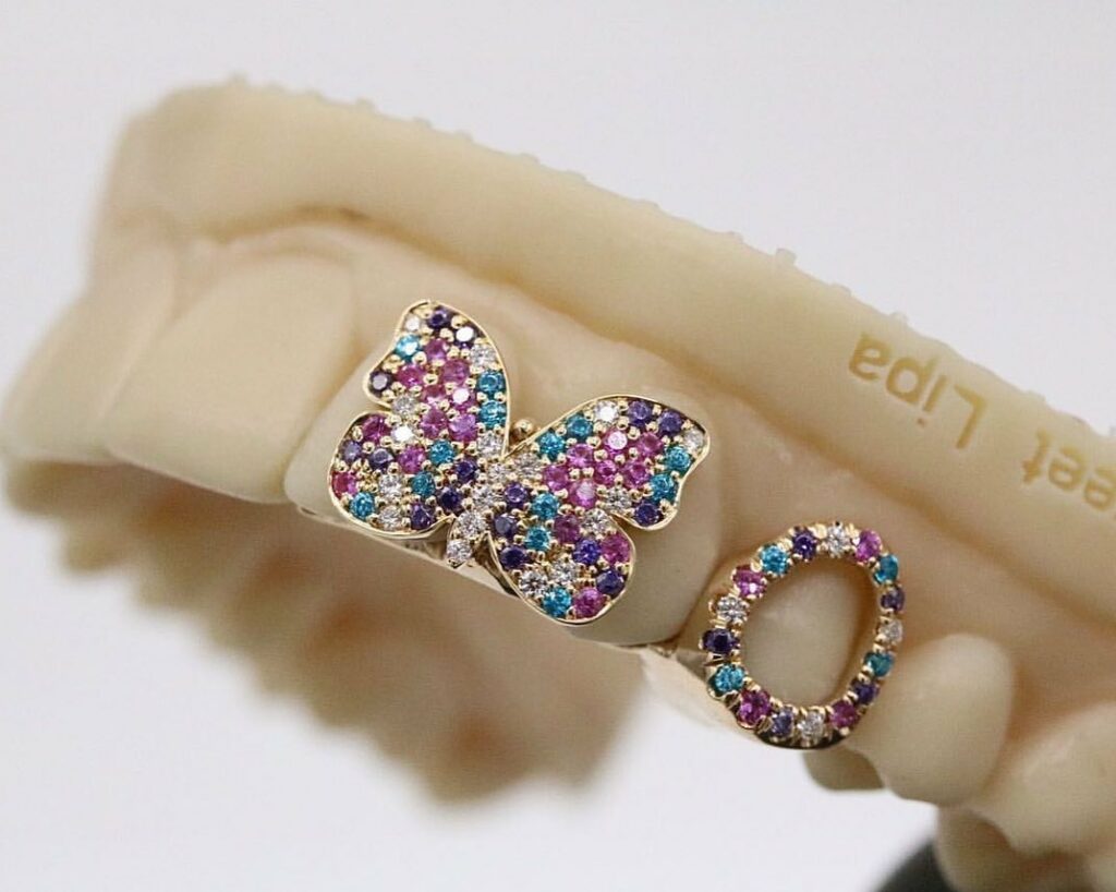 BEST Bling GRILLZ 2021 • Curated by SequinQueen